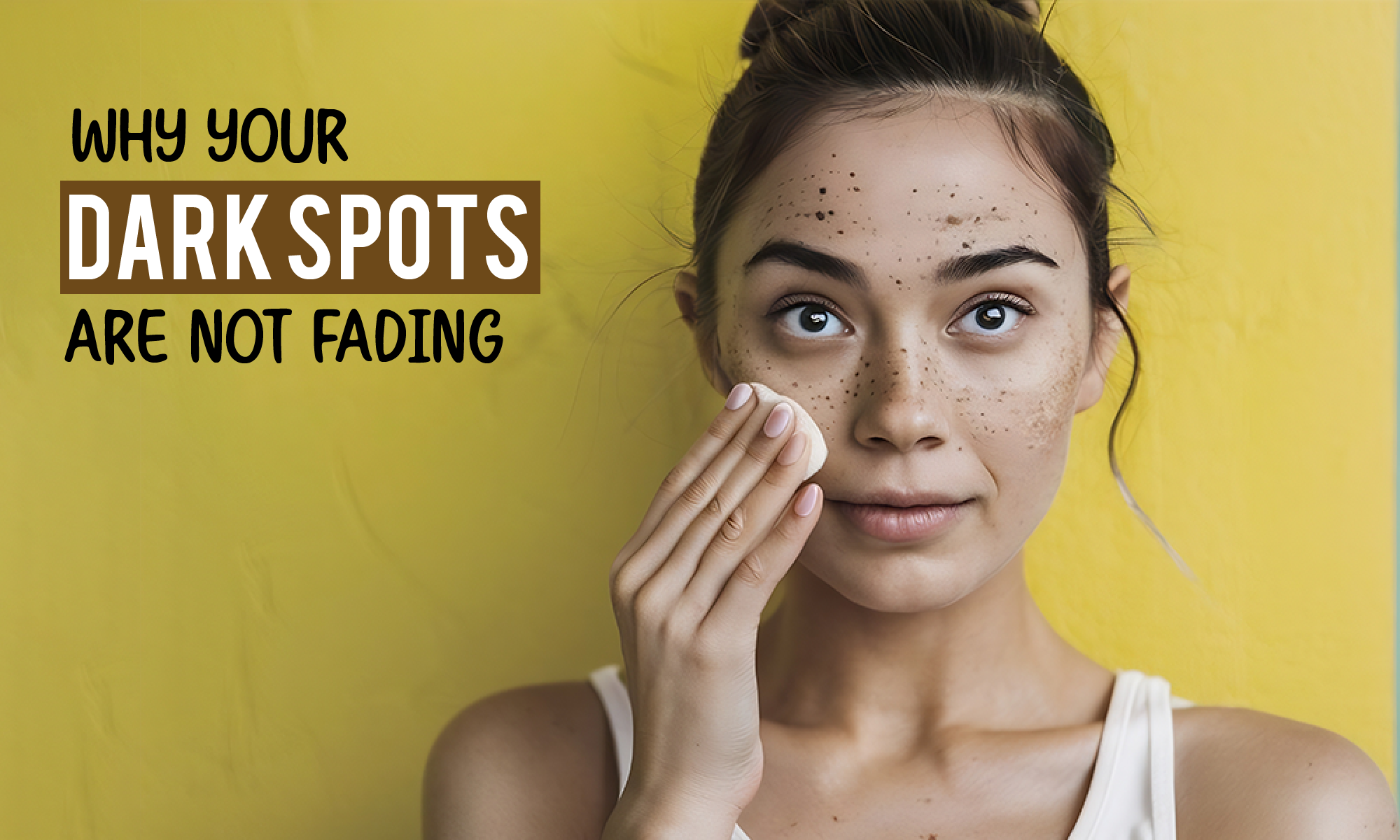 Why Dark Spots Are Not Fading & How Melacid Glow Duo Fixes Them ...